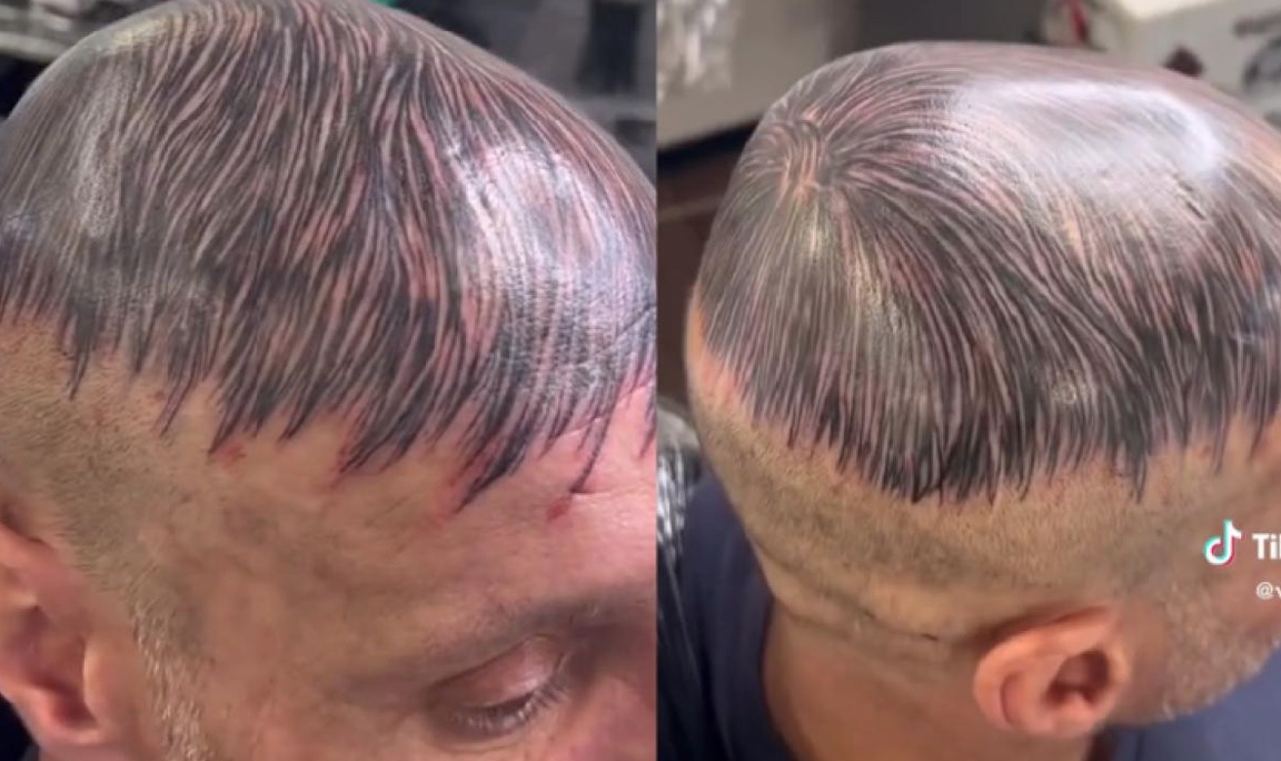 Hombre se tatúa "pelo" en su cabeza rapada para ocultar calvicie y se ...